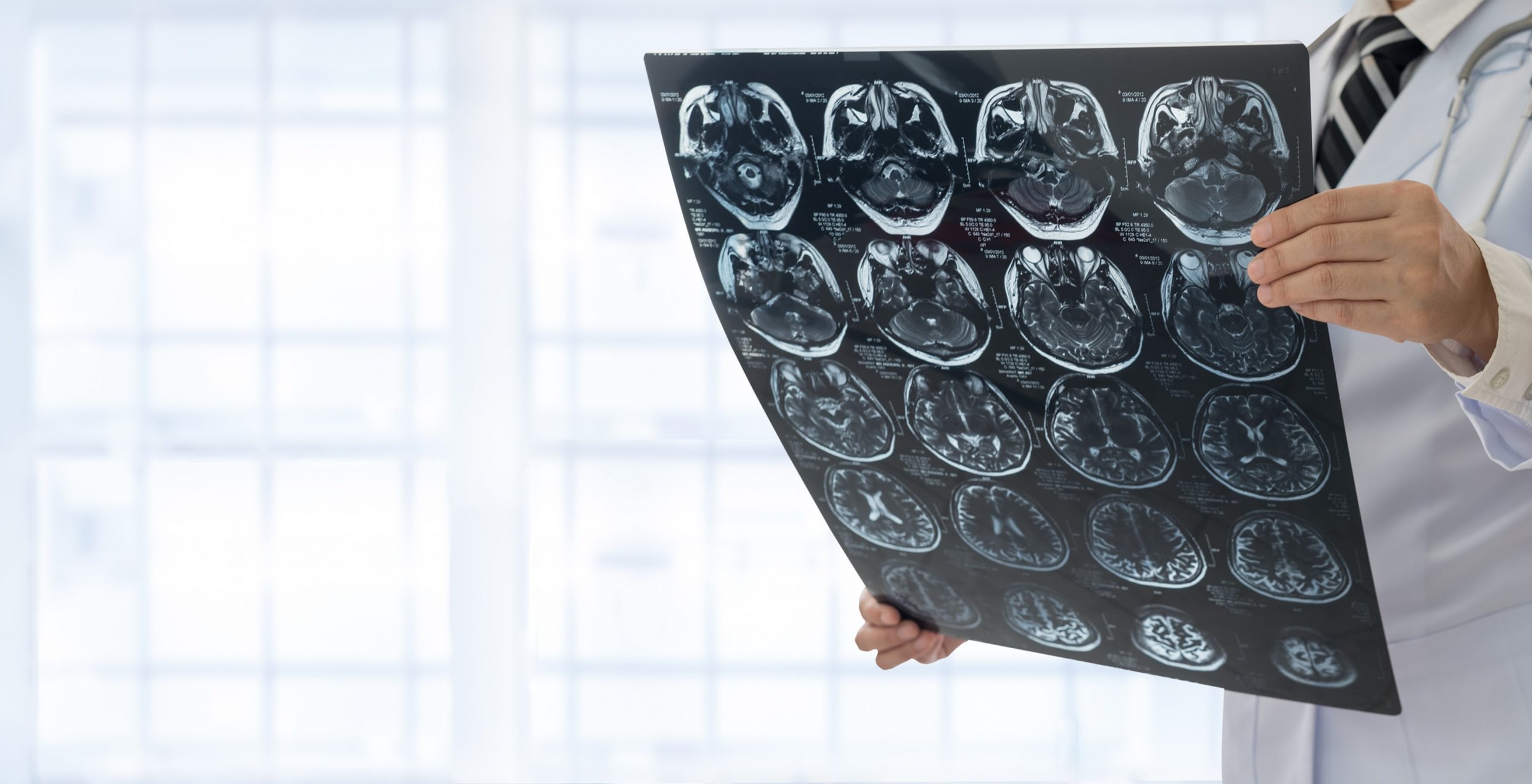 Stroke Care - Richmond University Medical Center