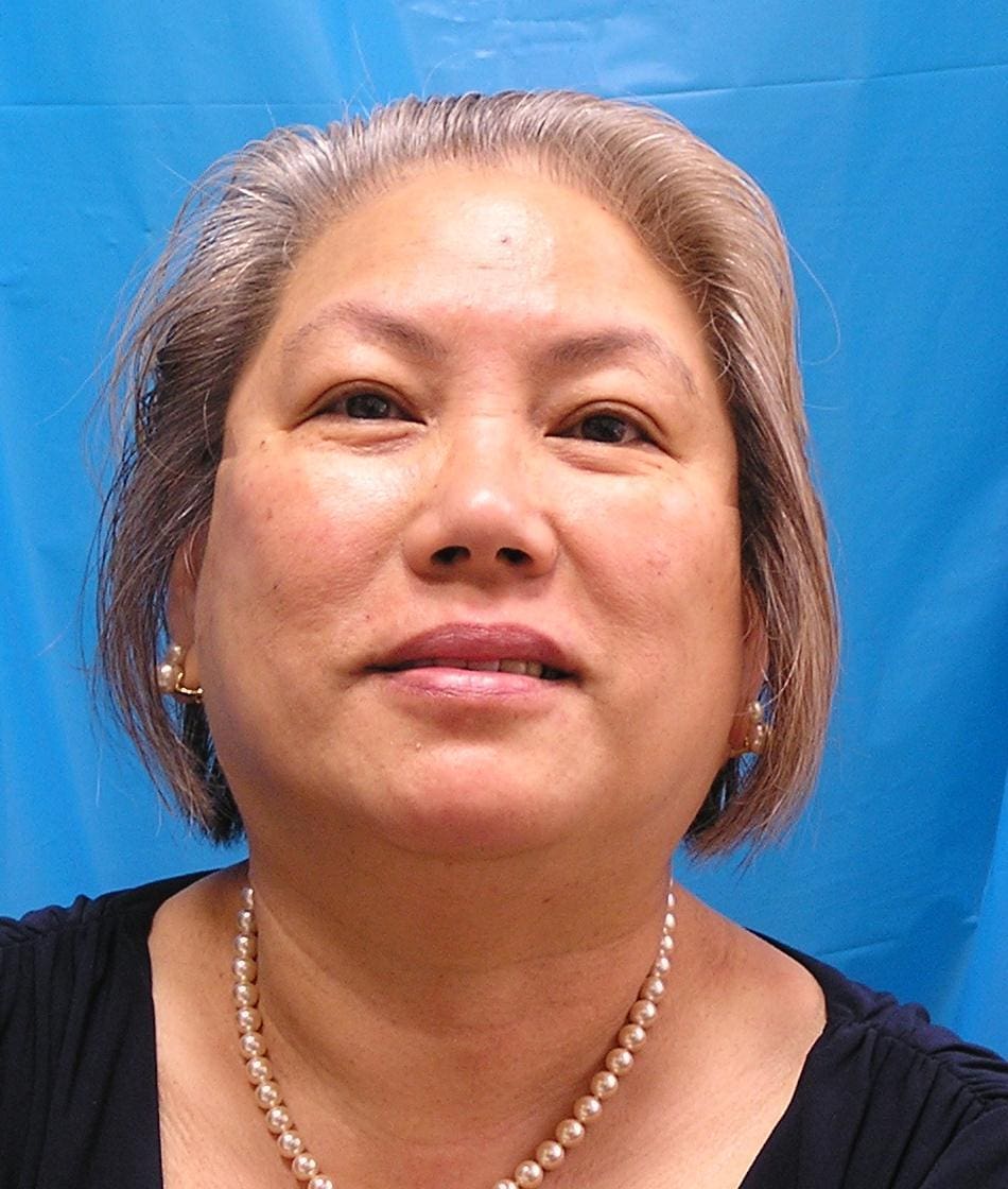 Bunag Maria, MD - Richmond University Medical Center